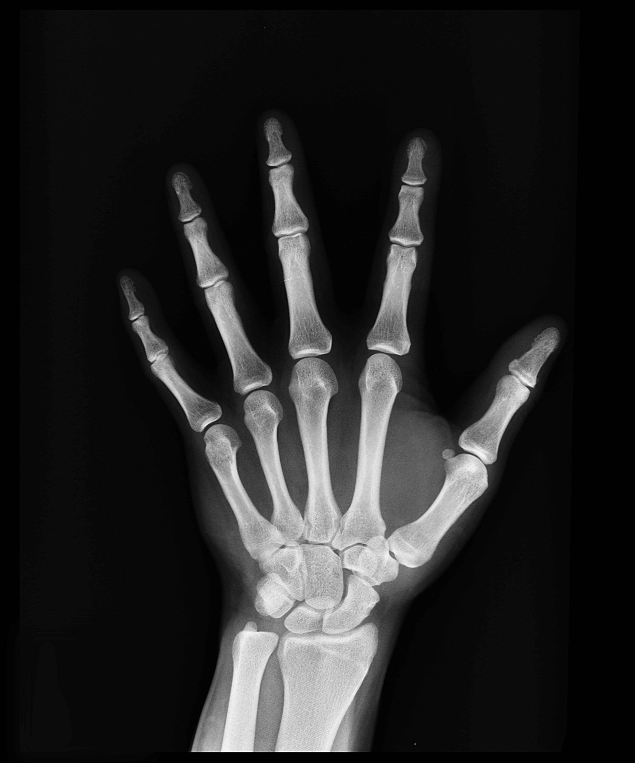 Avoiding Hand Injuries In The Workplace - Healthscreen UK